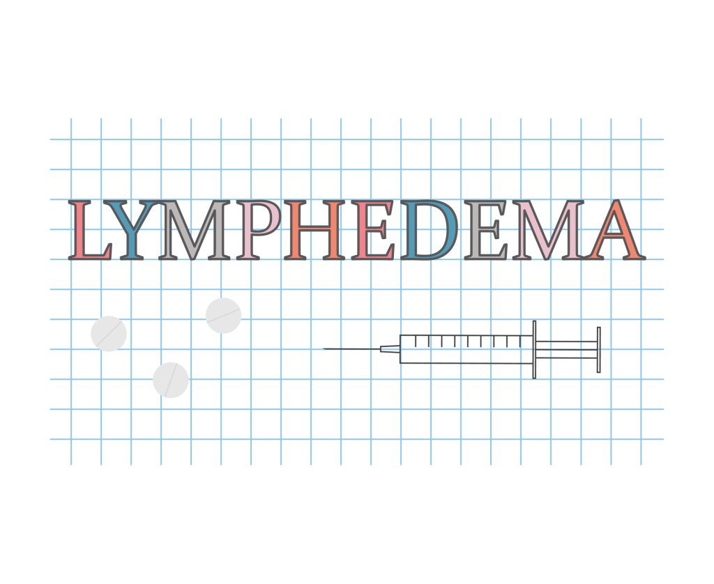 Spotlight On: Lymphatic System and Lymphedema - I Spy Physiology Blog