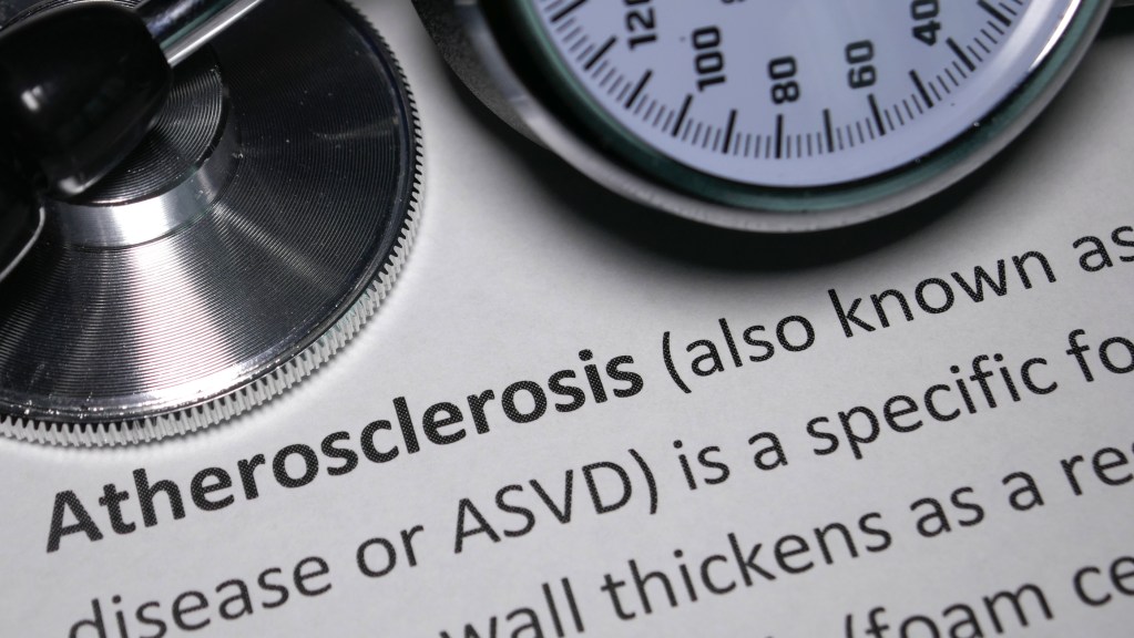 Spotlight On: Atherosclerosis and Cholesterol - I Spy Physiology Blog